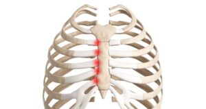 Costochondritis Physical Therapy Exercises Your Guide | BestHealthExpert